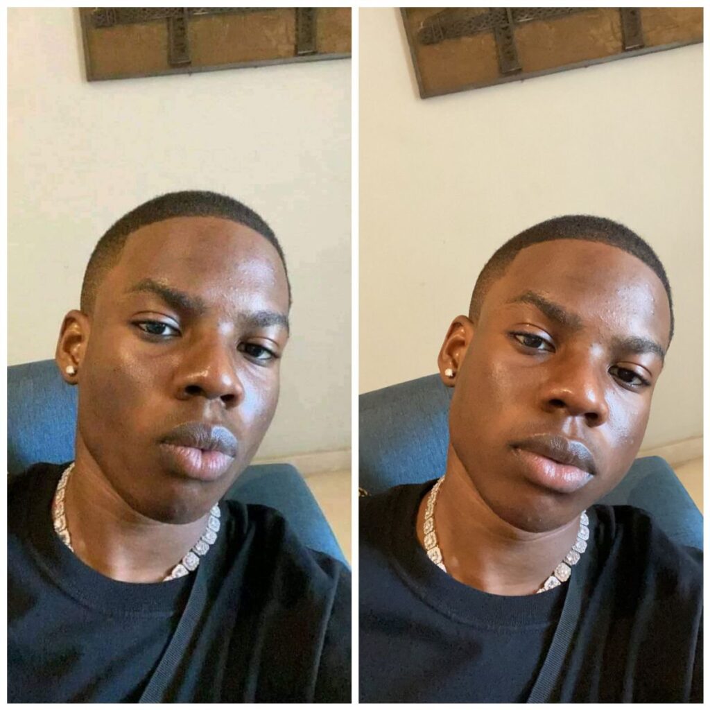 #EndSARS: Rema Gets Rid Of His Dreads To Support The Ongoing Protests ...